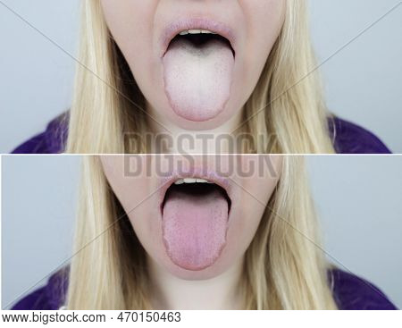 Woman Has Yellow Image & Photo (Free Trial) | Bigstock