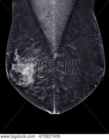 X-ray Digital Image & Photo (Free Trial) | Bigstock
