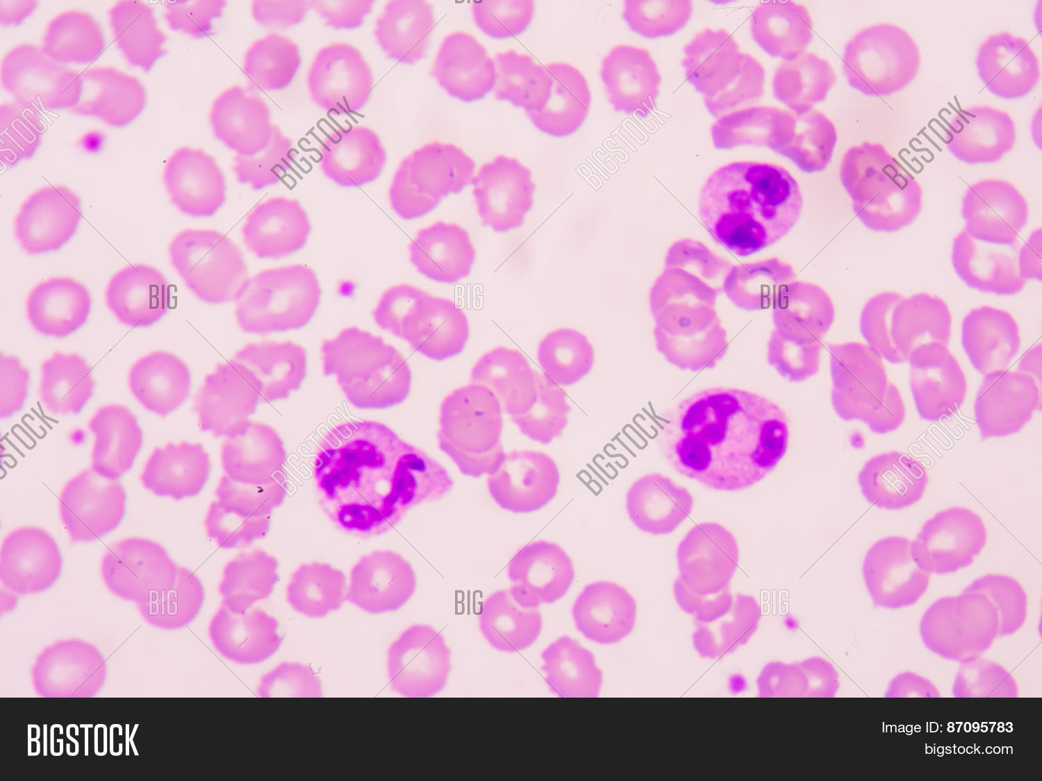 Toxic Granulation Image & Photo (Free Trial) | Bigstock