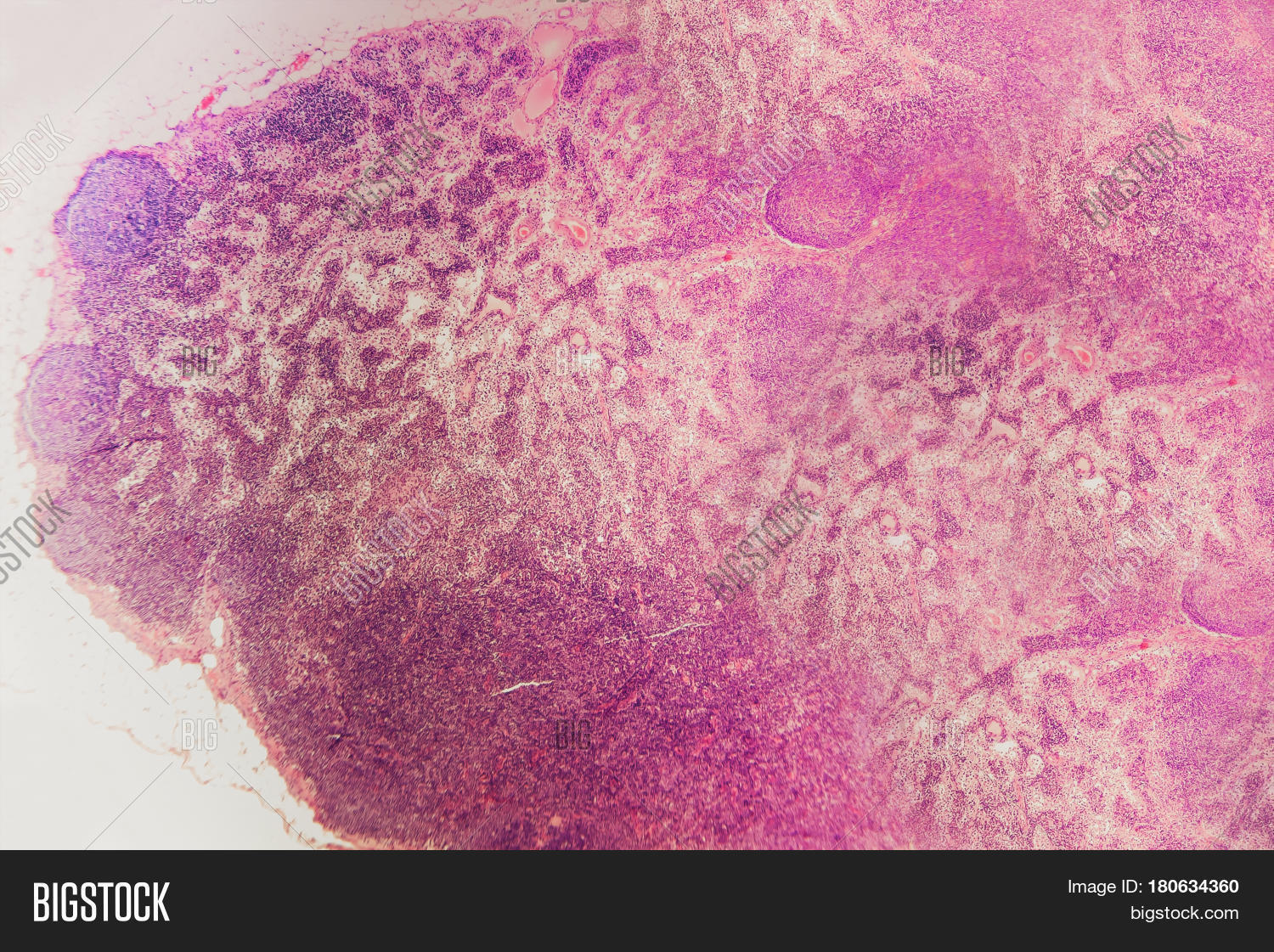 Lymph Node Microscope Slide