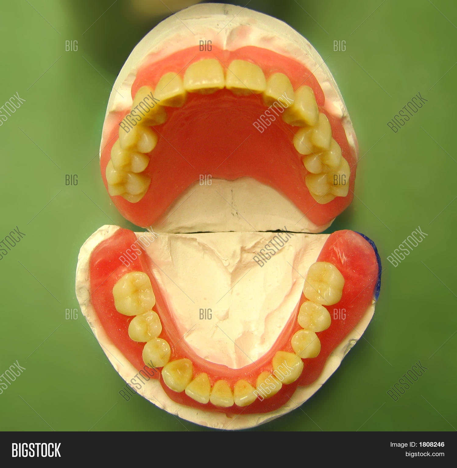 Wide Open Denture Image & Photo (Free Trial) | Bigstock
