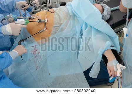 Endoscopy. Surgery On Image & Photo (Free Trial) | Bigstock