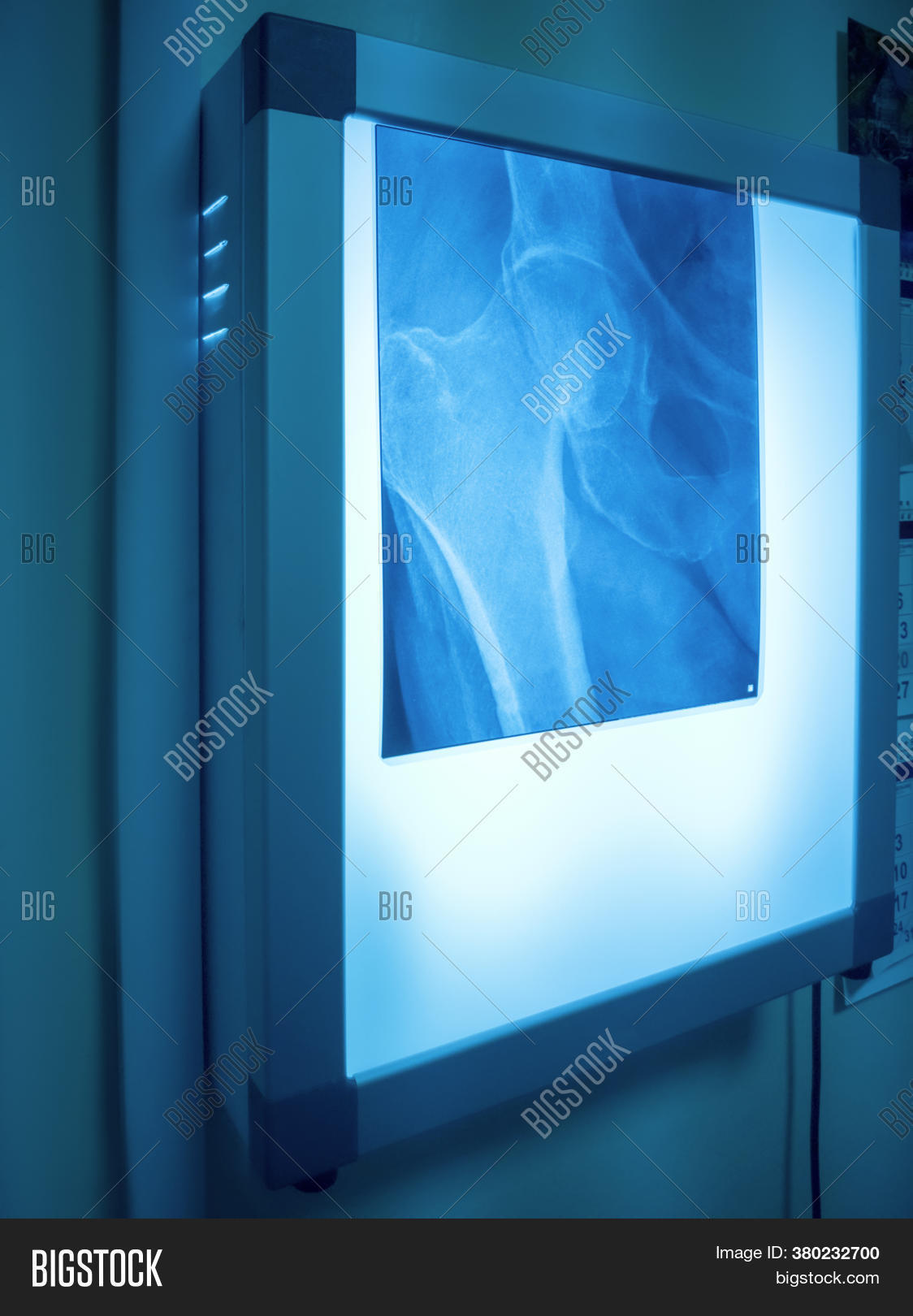 Glowing Negatoscope X- Image & Photo (Free Trial) | Bigstock