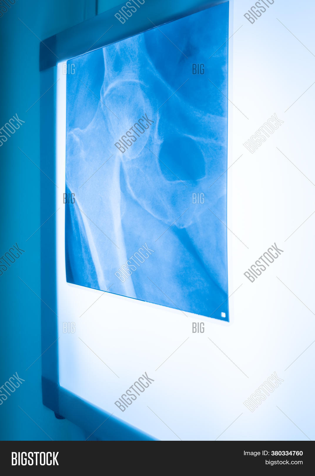 Luminous X-ray Viewer Image & Photo (Free Trial) | Bigstock
