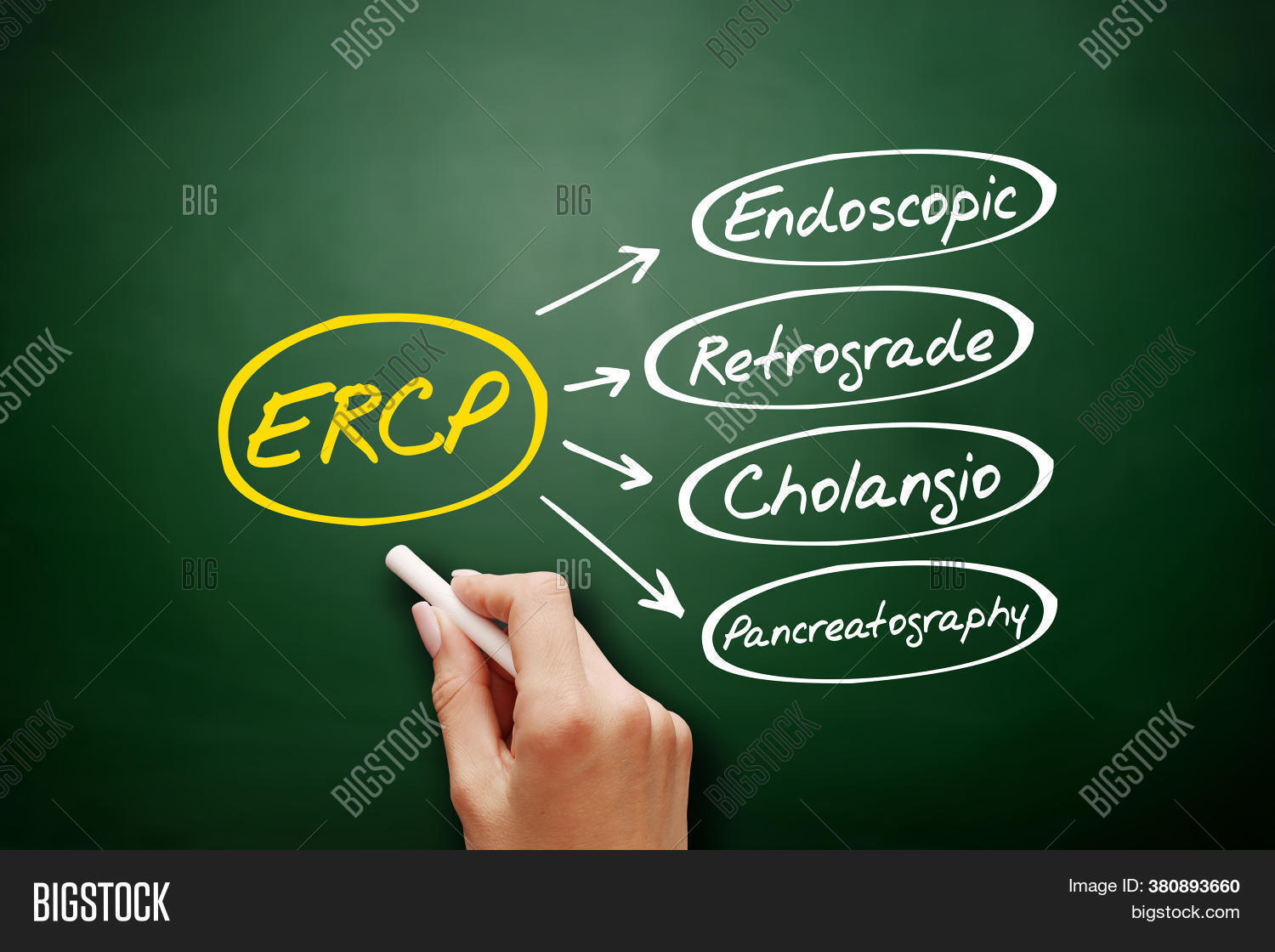 Ercp - Endoscopic Image & Photo (Free Trial) | Bigstock