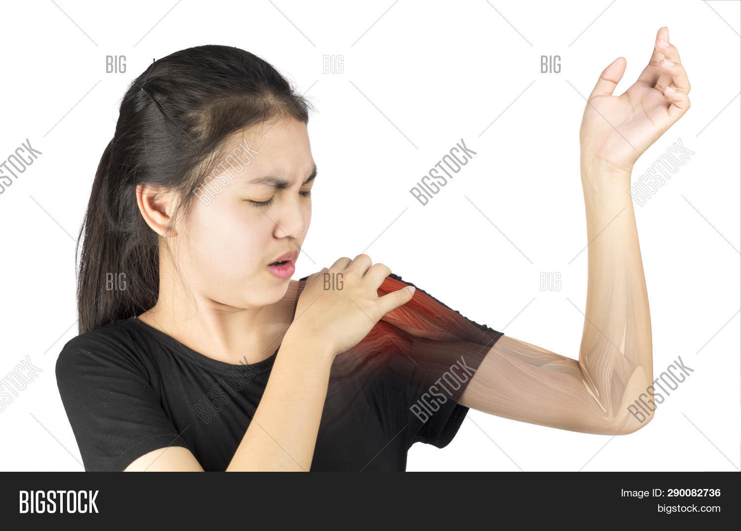 Shoulder Muscle Injury Image & Photo (Free Trial) | Bigstock