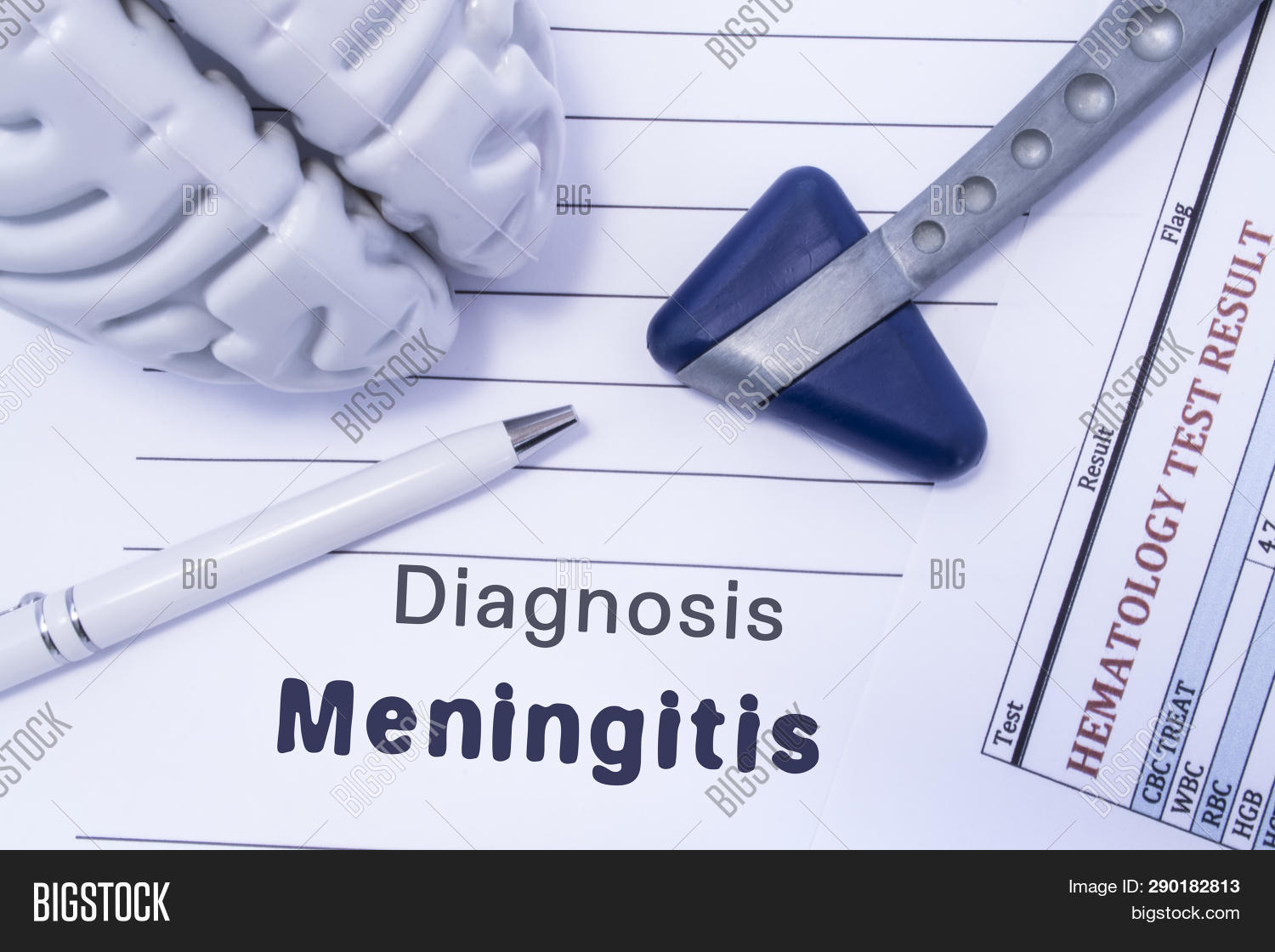Diagnosis Meningitis. Image & Photo (Free Trial) | Bigstock