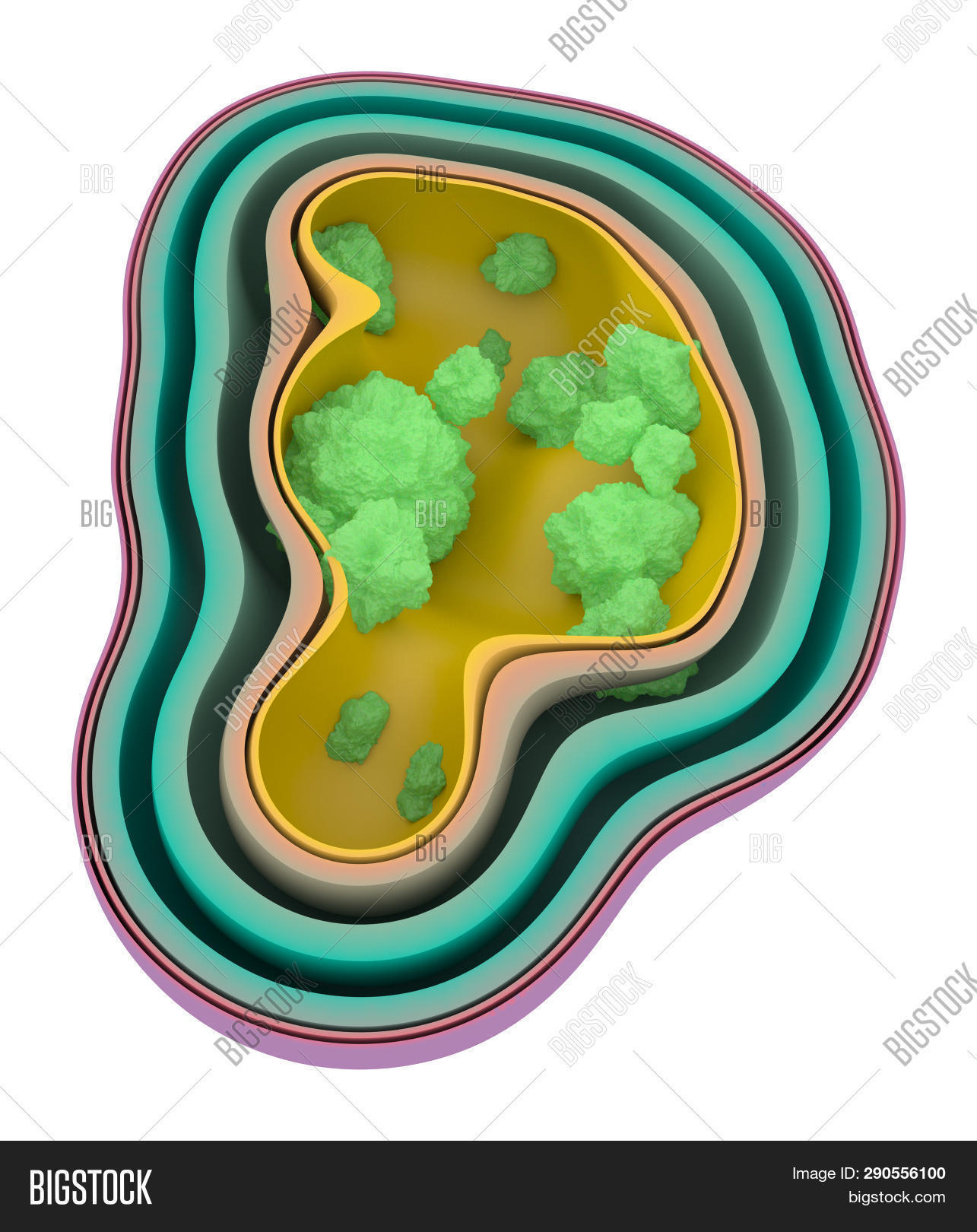 Cross Section Infected Image & Photo (Free Trial) | Bigstock