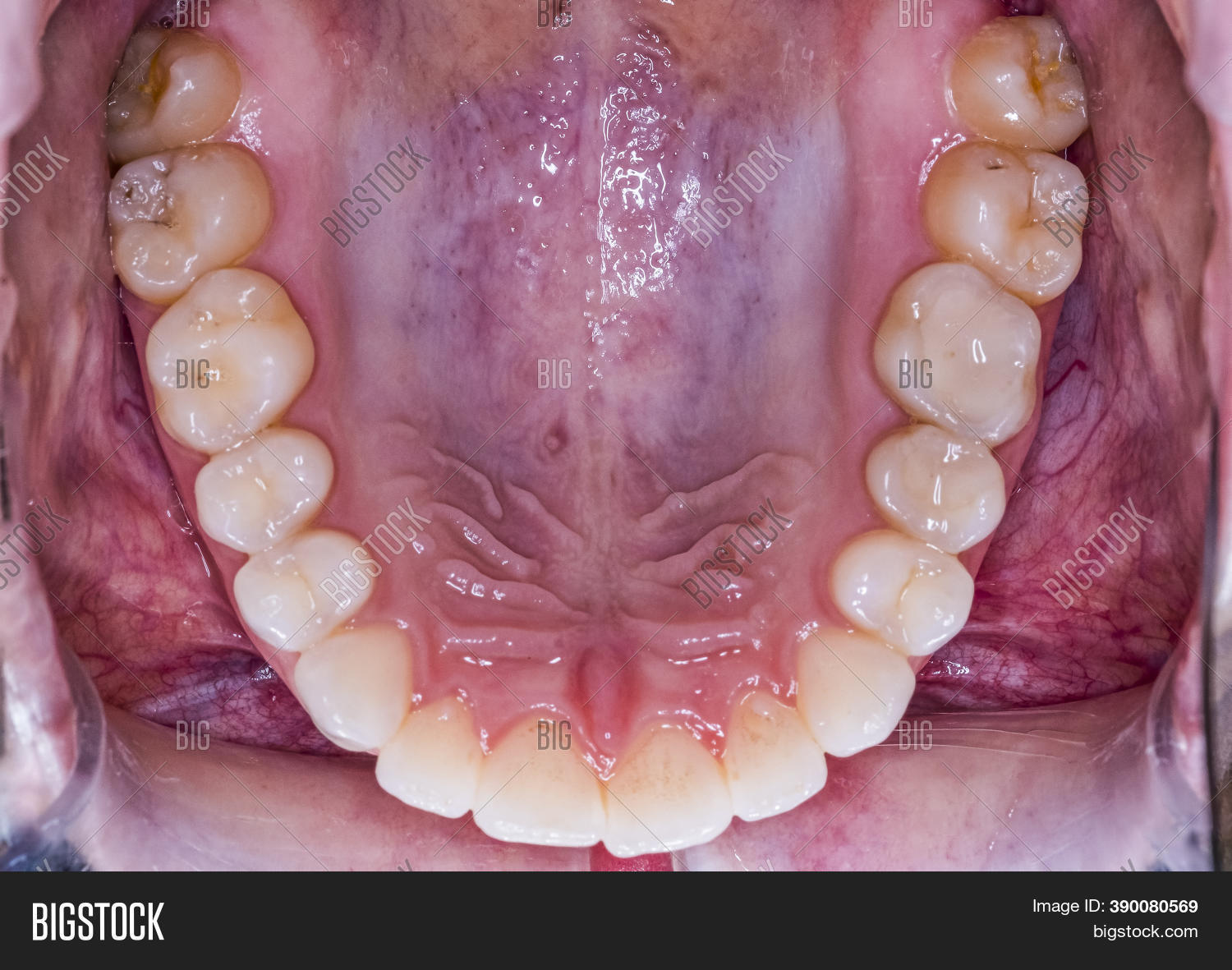 Picture Woman Jaw Image & Photo (Free Trial) | Bigstock