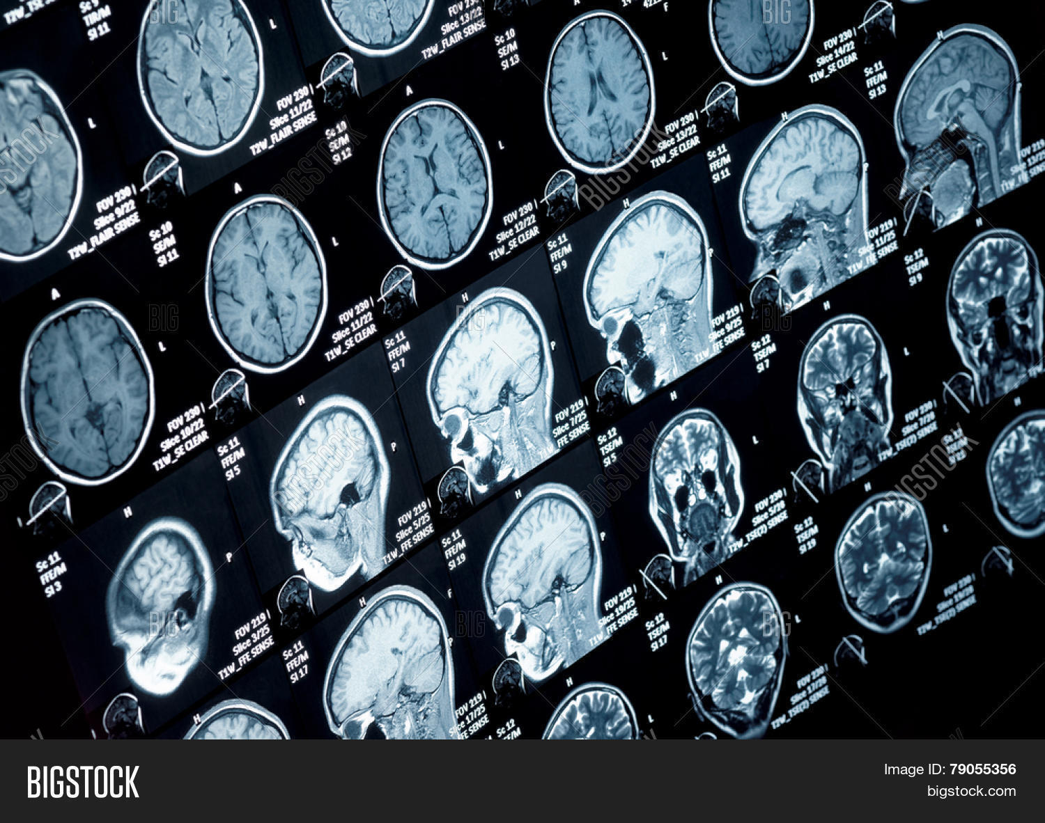 Head Neck MRI Scan, Image & Photo (Free Trial) | Bigstock