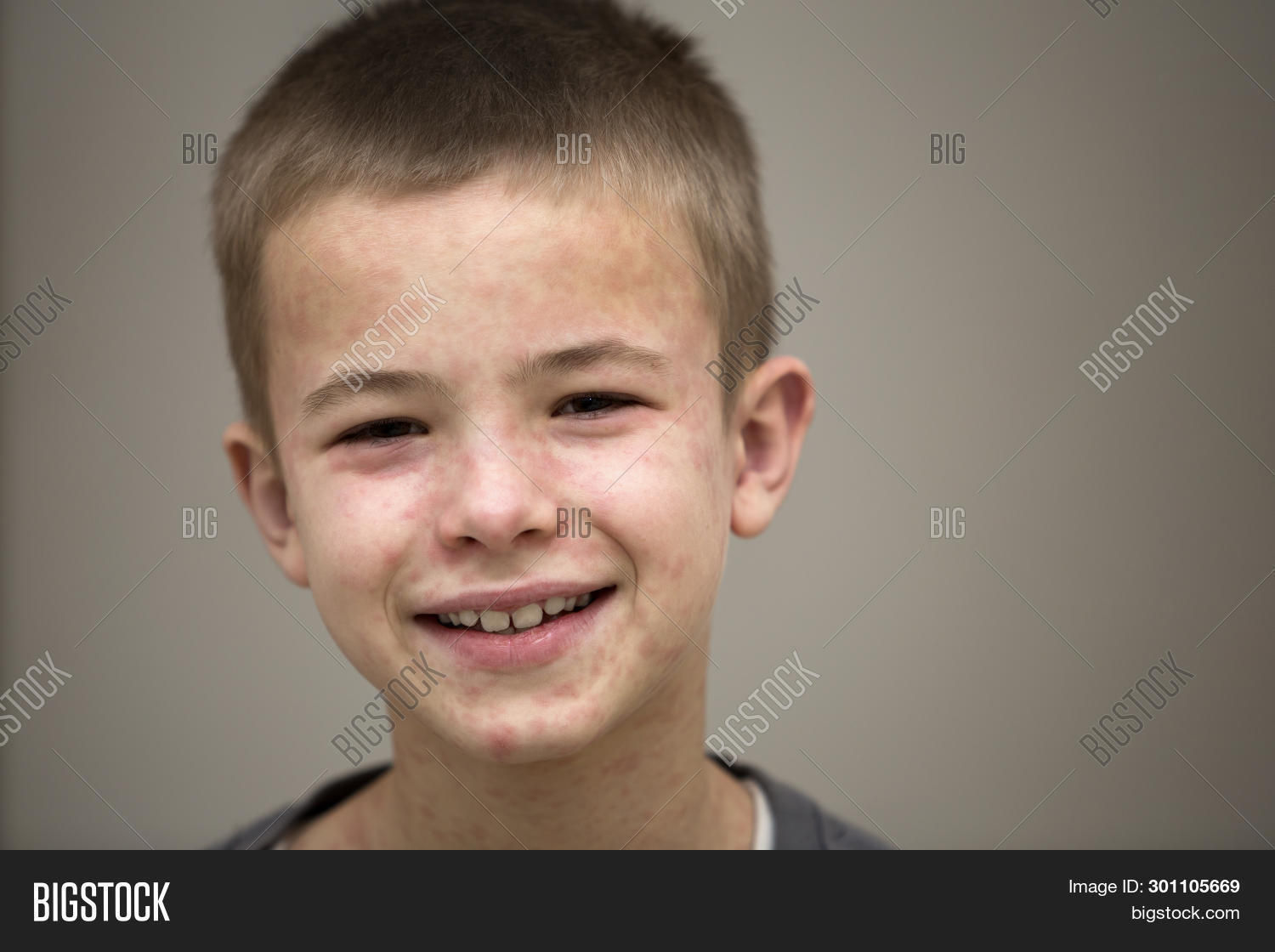 Portrait Sick Smiling Image & Photo (Free Trial) | Bigstock