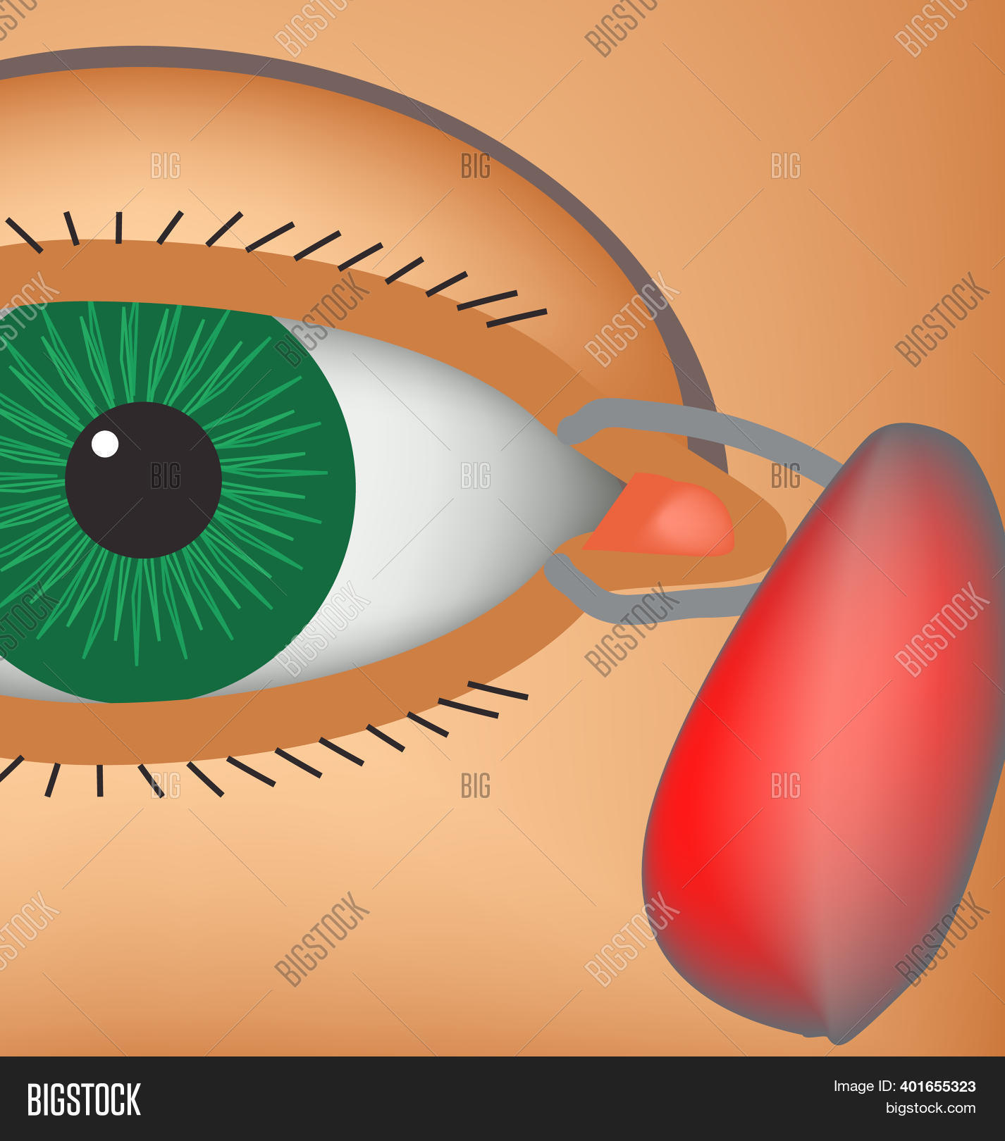 Dacryocyst. Image & Photo (Free Trial) | Bigstock