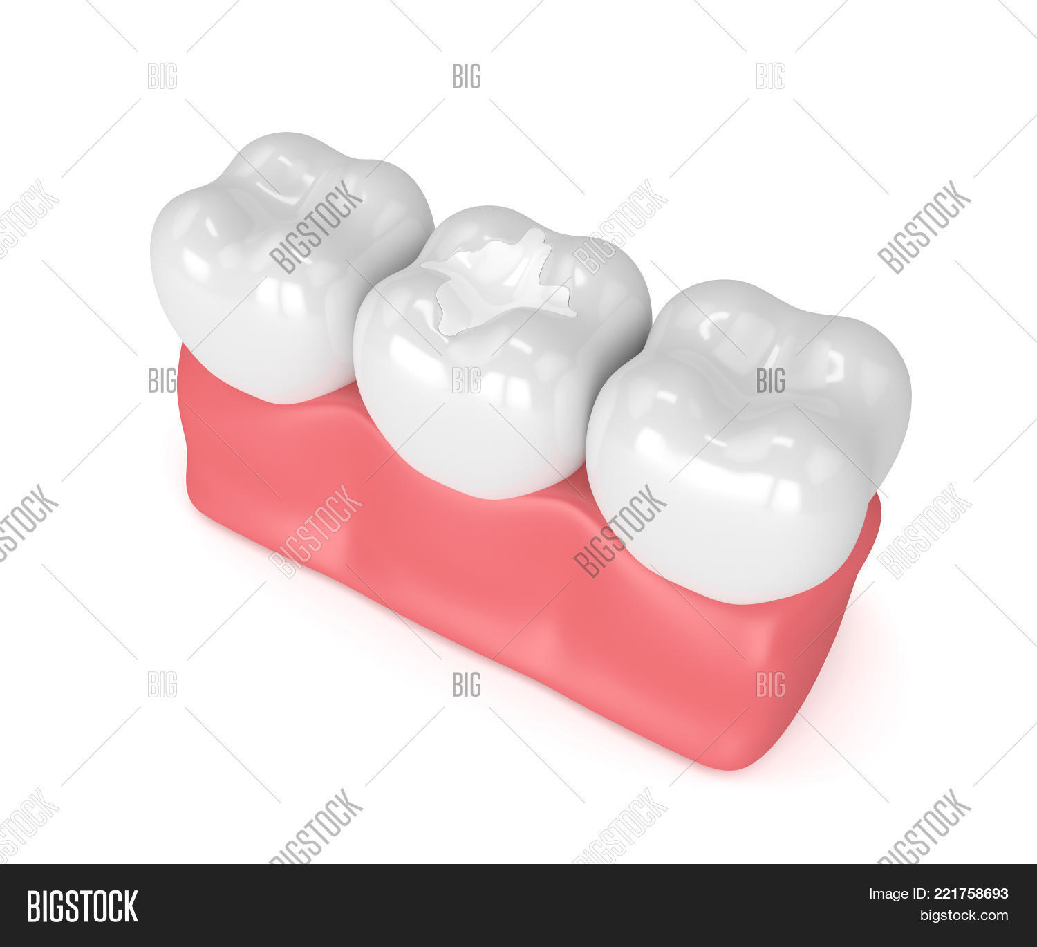 3d Render Teeth Dental Image & Photo (Free Trial) | Bigstock