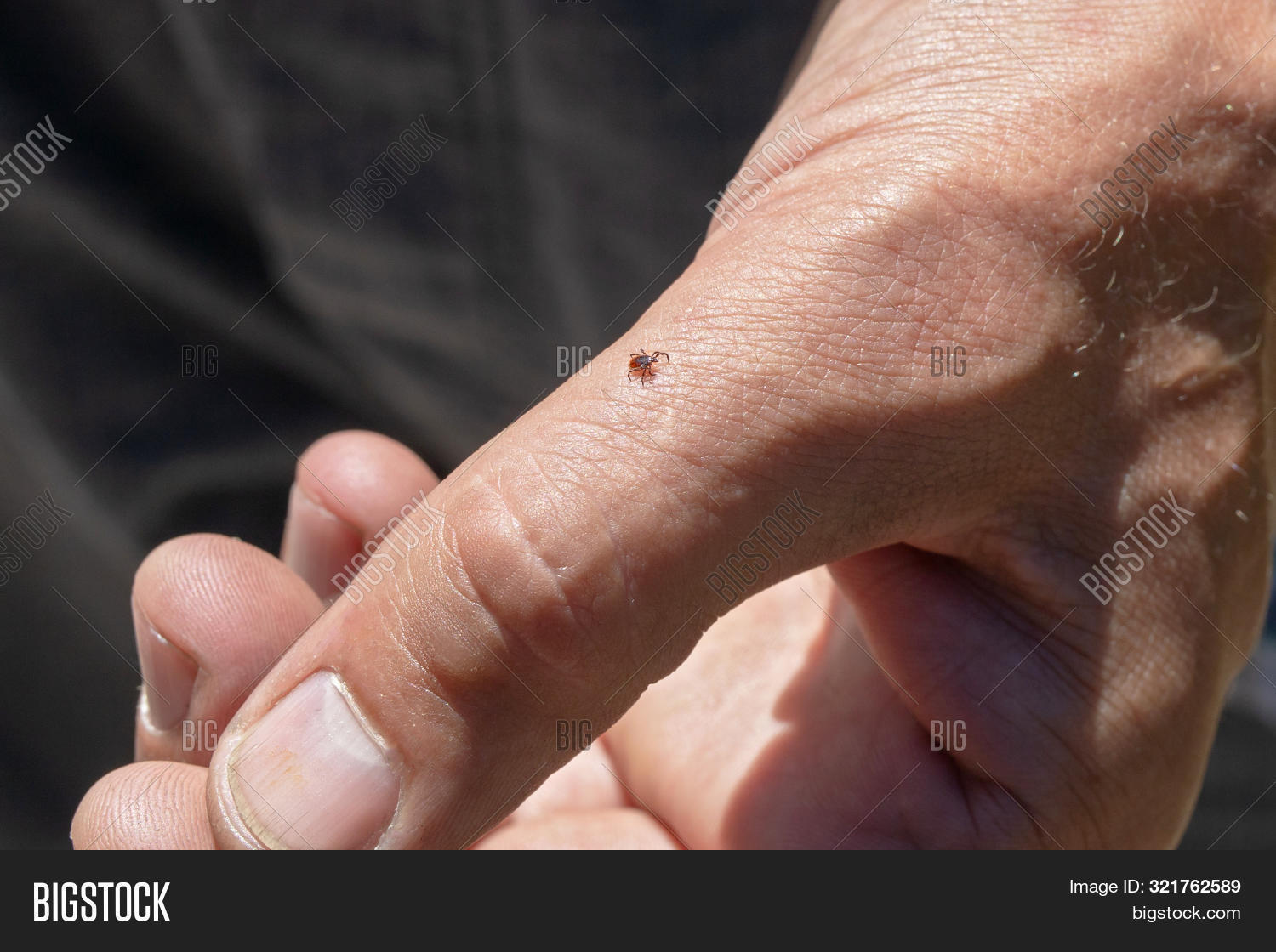 Tick On Human Hand. Image & Photo (Free Trial) | Bigstock