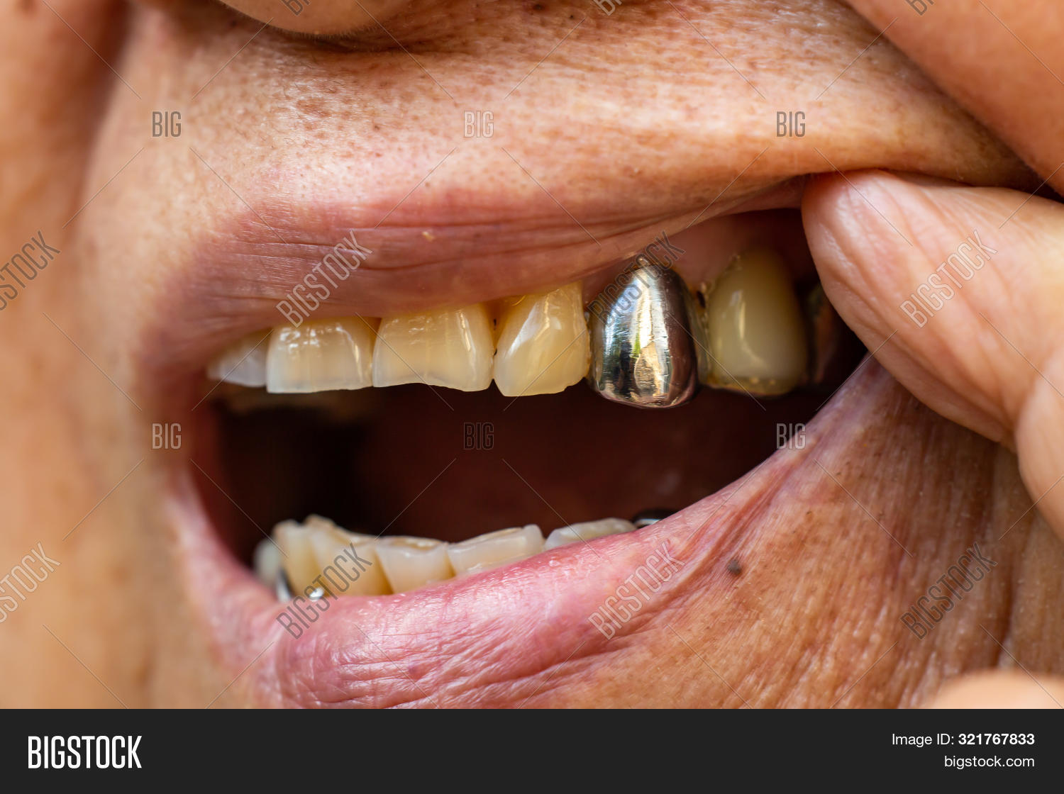 Siver Metal Artificial Image & Photo (Free Trial) | Bigstock