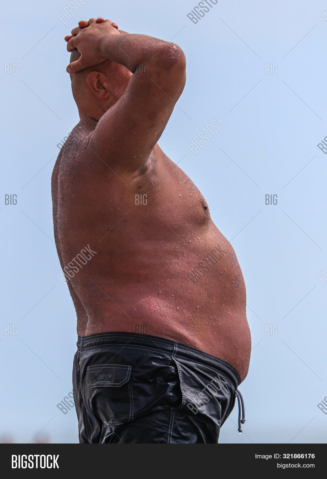 Fat Man Burned Sun. Image & Photo (Free Trial) | Bigstock