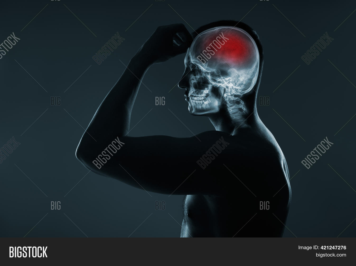X-ray Man's Head. Image & Photo (Free Trial) | Bigstock