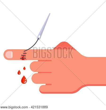 Sew Wound On Arm. Vector & Photo (Free Trial) | Bigstock