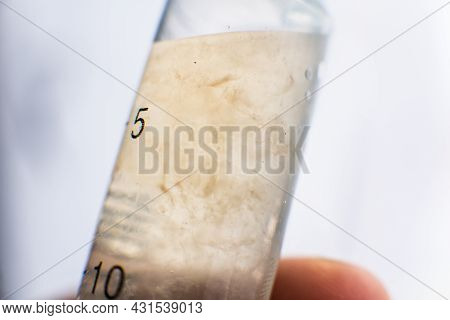 Psilocybin Mushroom. Image & Photo (Free Trial) | Bigstock