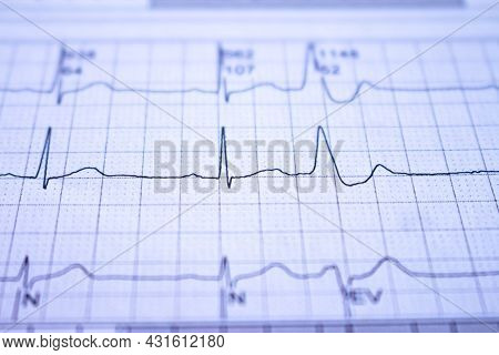 Heartbeat Recorded On Image & Photo (Free Trial) | Bigstock