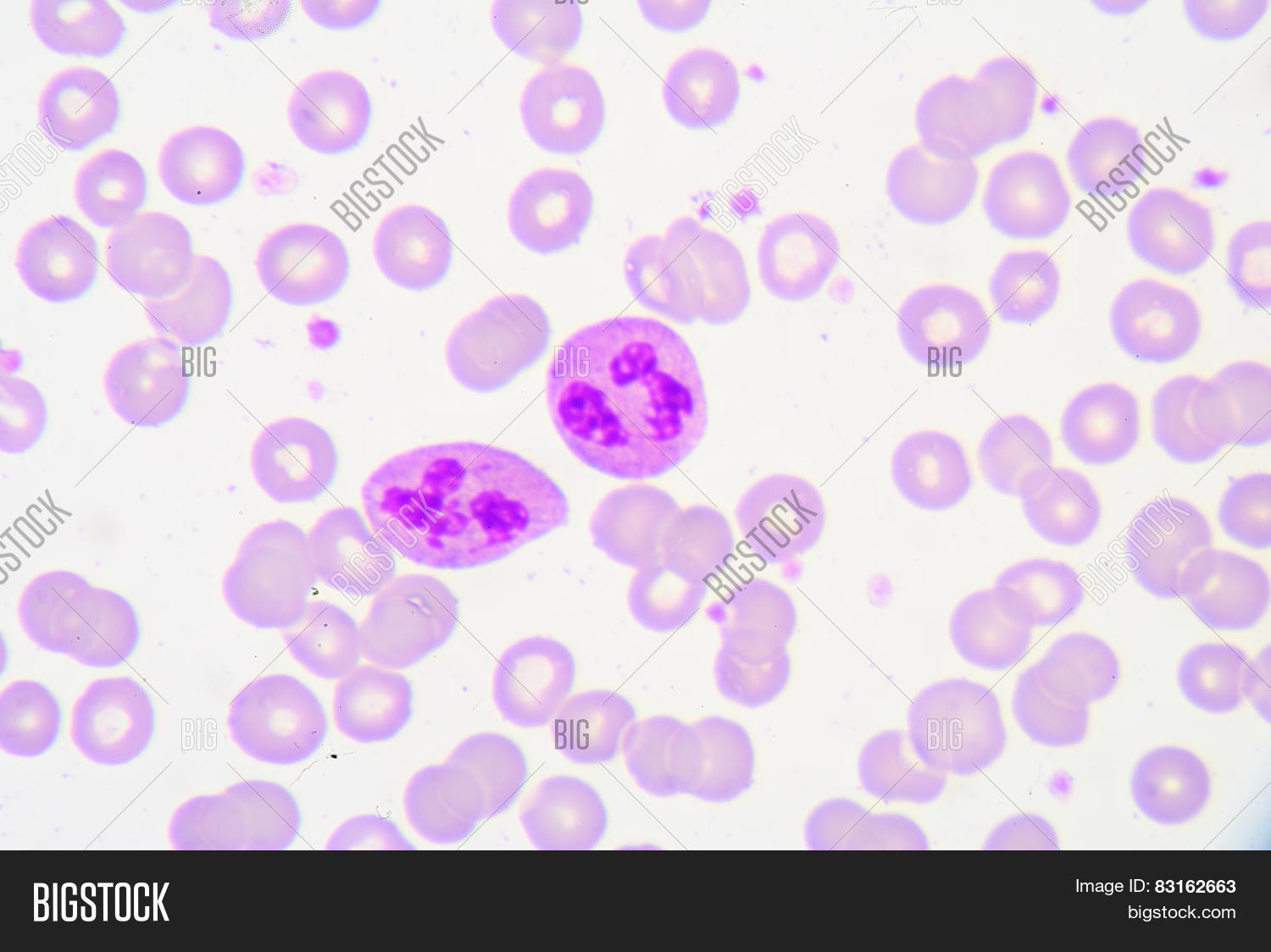 Pmn Toxic Granule Image & Photo (Free Trial) | Bigstock