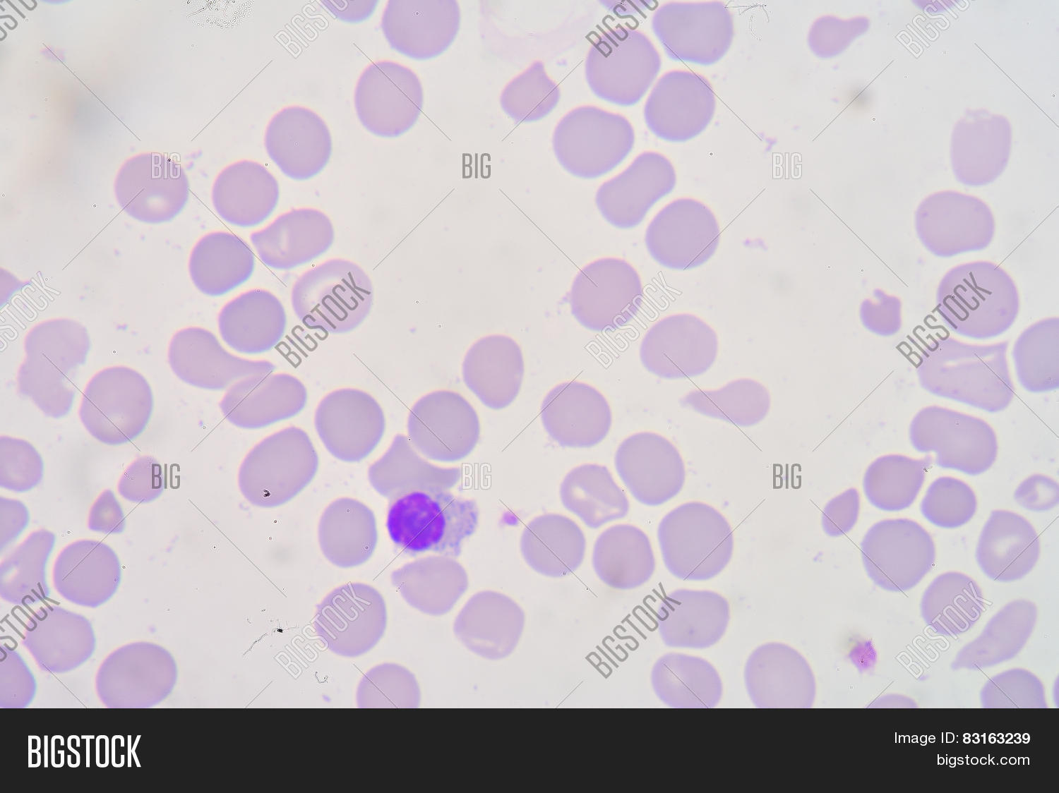 Blood Smear Beta Image & Photo (Free Trial) | Bigstock