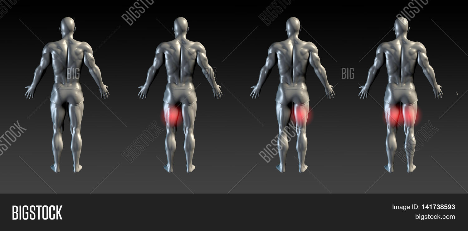 Hamstring Injury Red Image & Photo (Free Trial) | Bigstock
