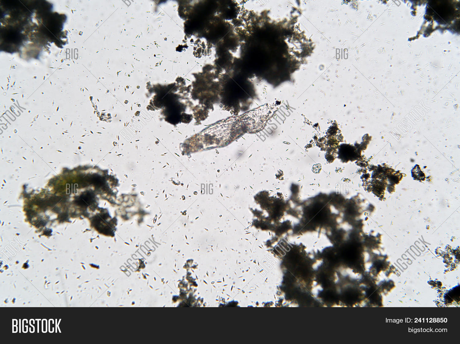 Rotifer Microscopic Image & Photo (Free Trial) | Bigstock