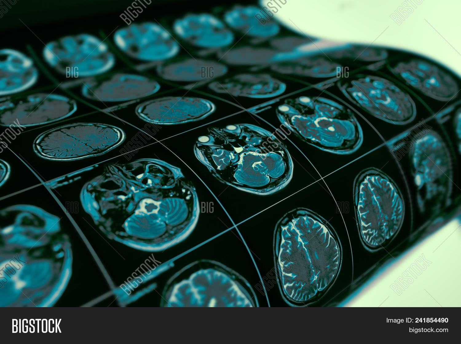 Mri Examination Film Image & Photo (Free Trial) | Bigstock