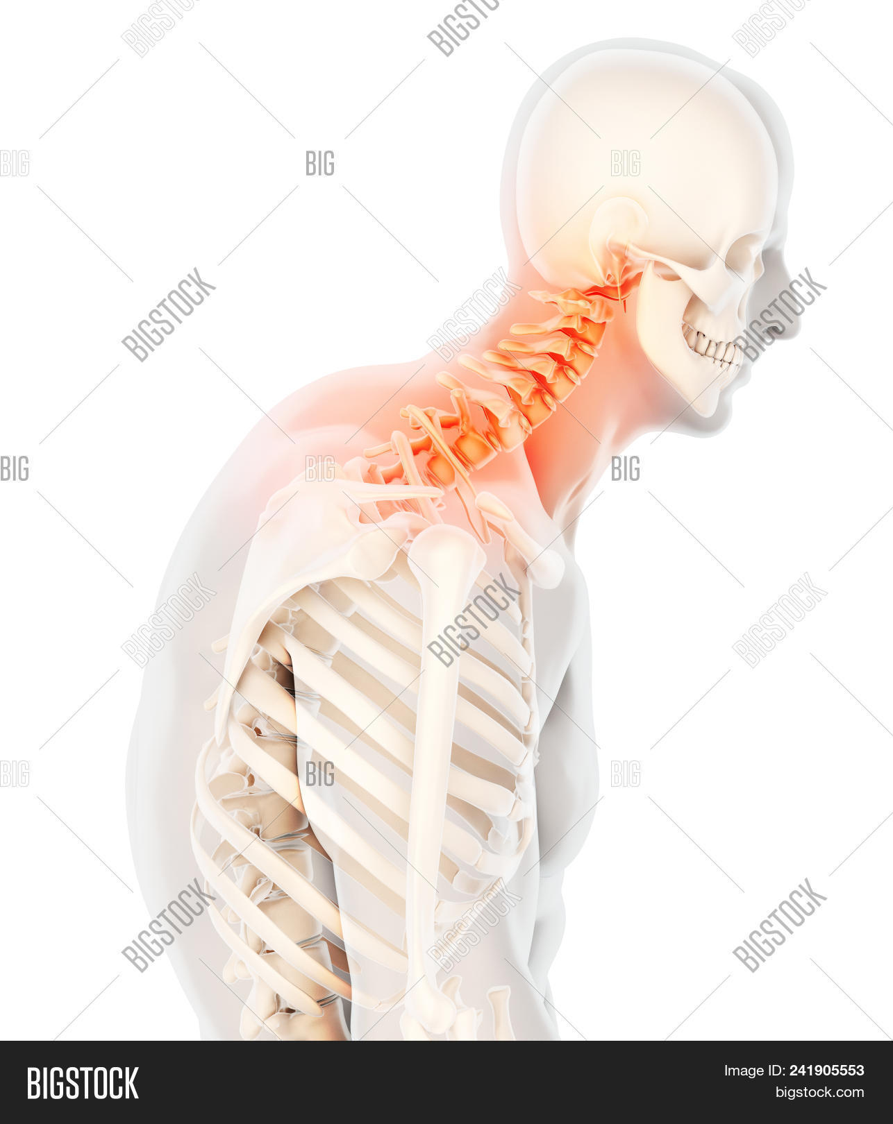3d Illustration, Neck Image & Photo (Free Trial) | Bigstock