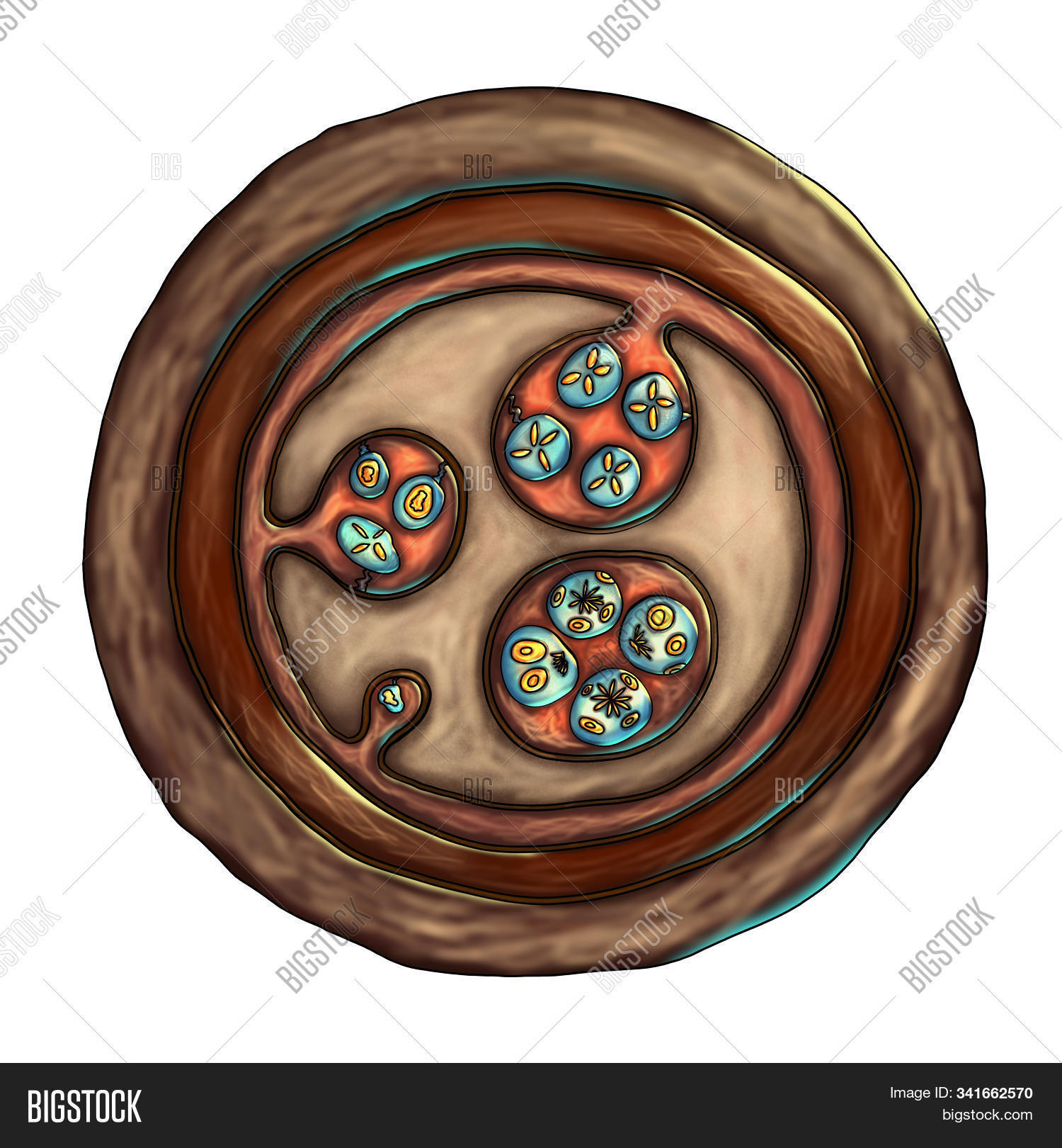 Structure Hydatid Cyst Image & Photo (Free Trial) | Bigstock