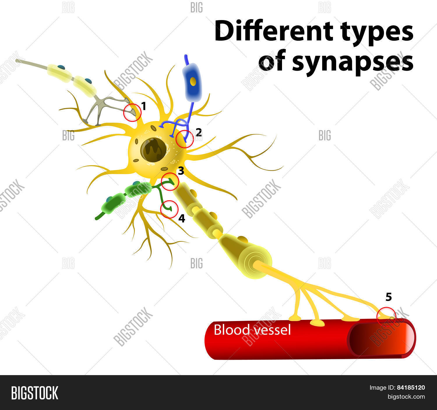 Different Types Vector & Photo (Free Trial) | Bigstock