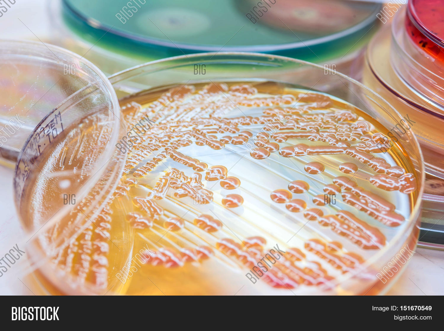 Bacterial Colonies Image & Photo (Free Trial) | Bigstock