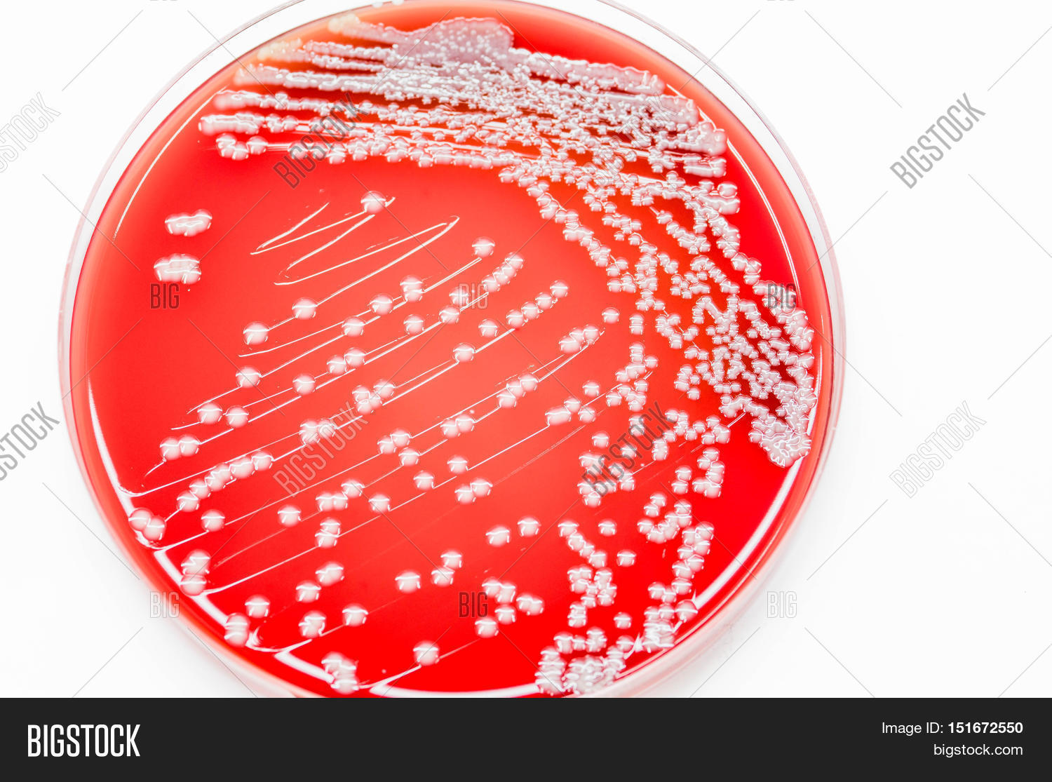 Bacterial Culture Image & Photo (Free Trial) | Bigstock
