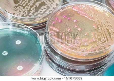 Bacterial Culture Image & Photo (Free Trial) | Bigstock