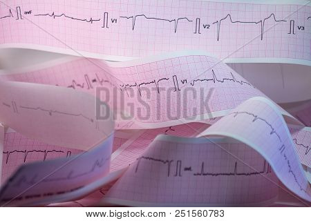 Strip Image & Photo (Free Trial) | Bigstock