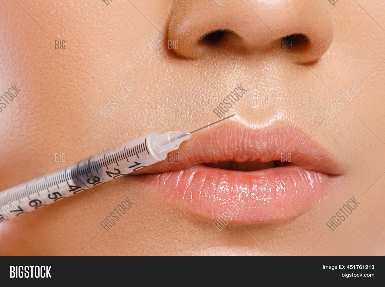 Female Lips Syringe Image & Photo (Free Trial) | Bigstock