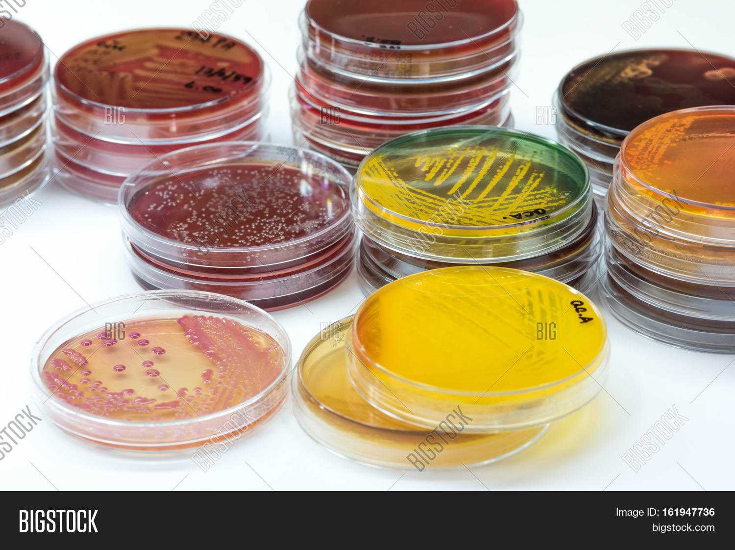 Bacterial Colonies Image & Photo (Free Trial) | Bigstock