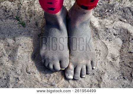 Dirty Feet Mud. Person Image & Photo (Free Trial) | Bigstock