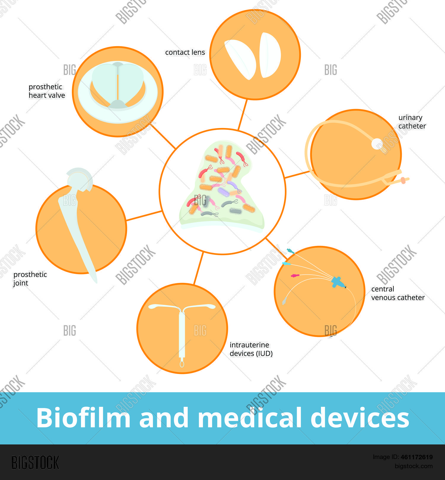 Biofilm Medical Vector & Photo (Free Trial) | Bigstock