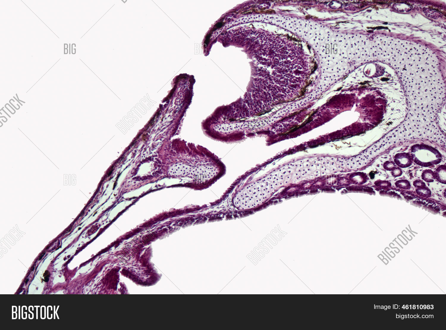Cross Section Nasal Image & Photo (Free Trial) | Bigstock