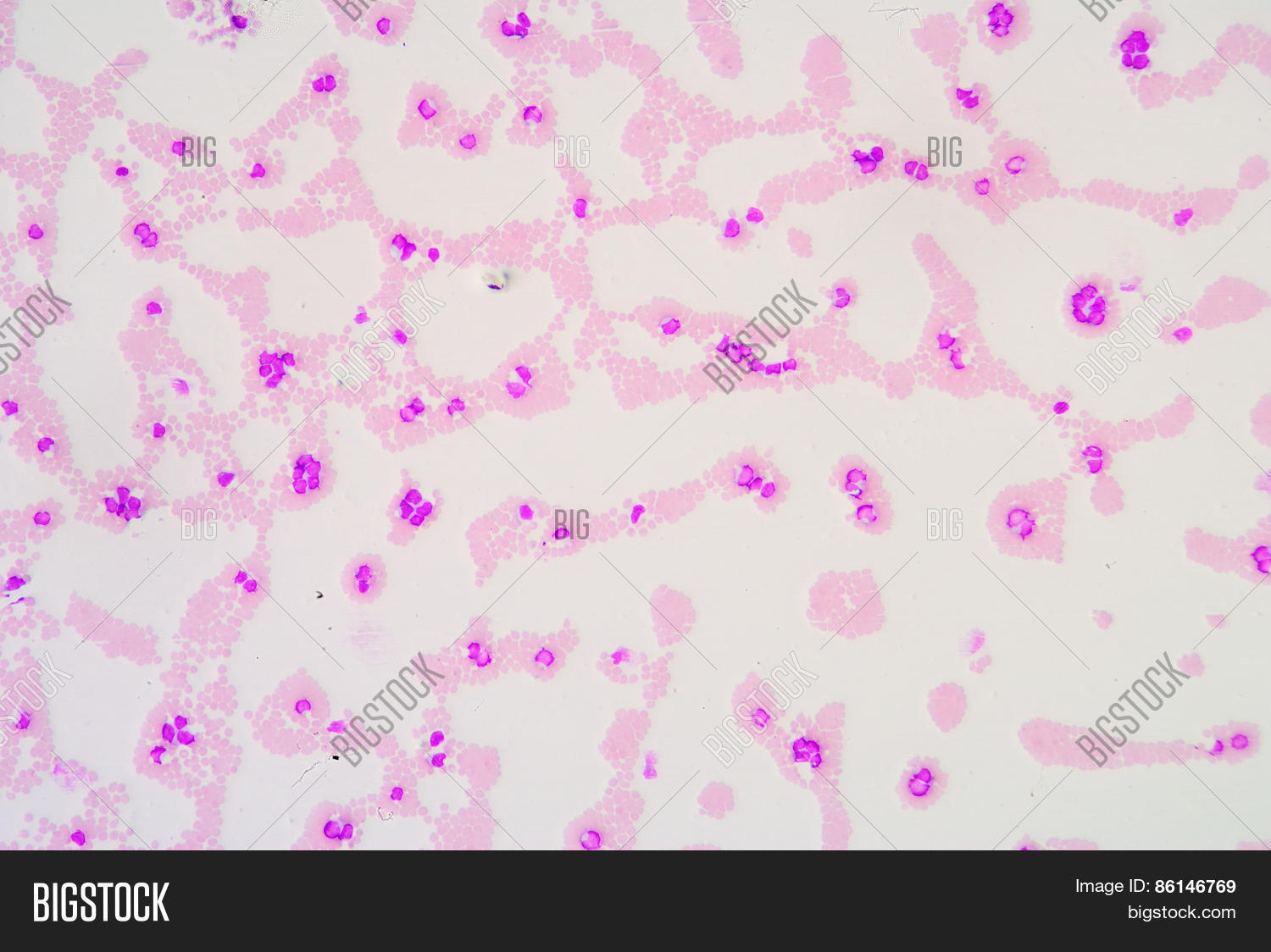 White Blood Cells Image & Photo (Free Trial) | Bigstock