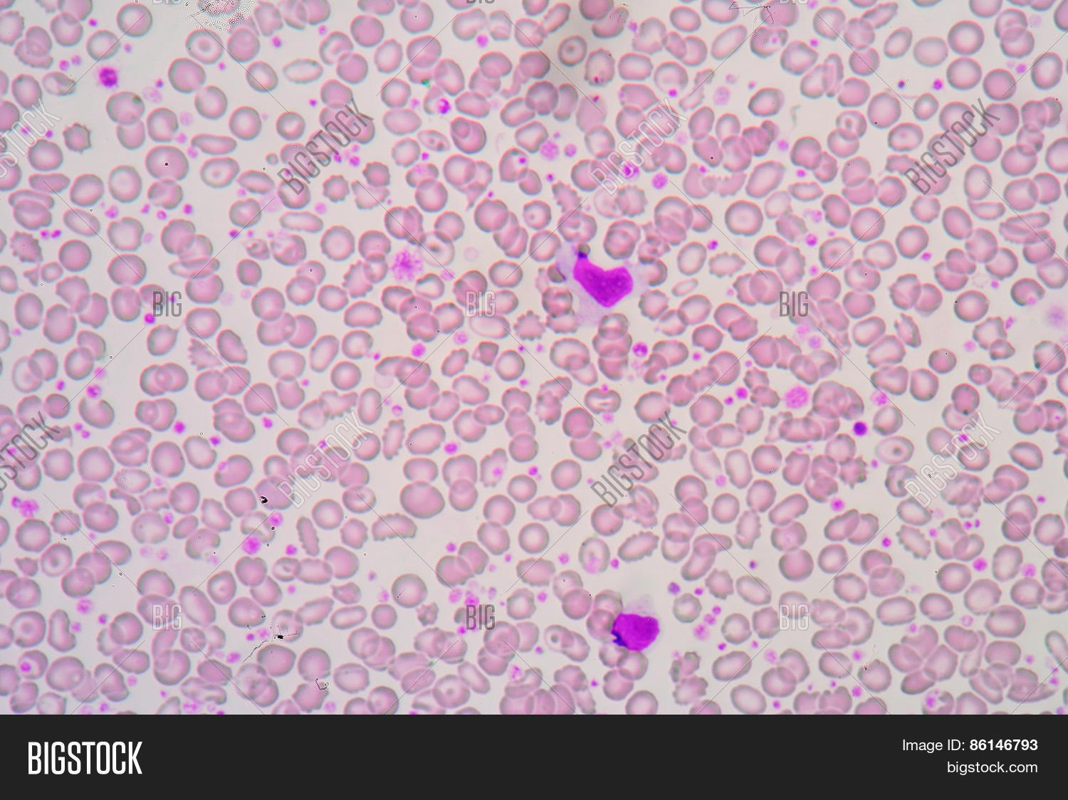 White Blood Cells Image & Photo (Free Trial) | Bigstock