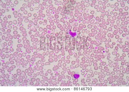 White Blood Cells Image & Photo (Free Trial) | Bigstock
