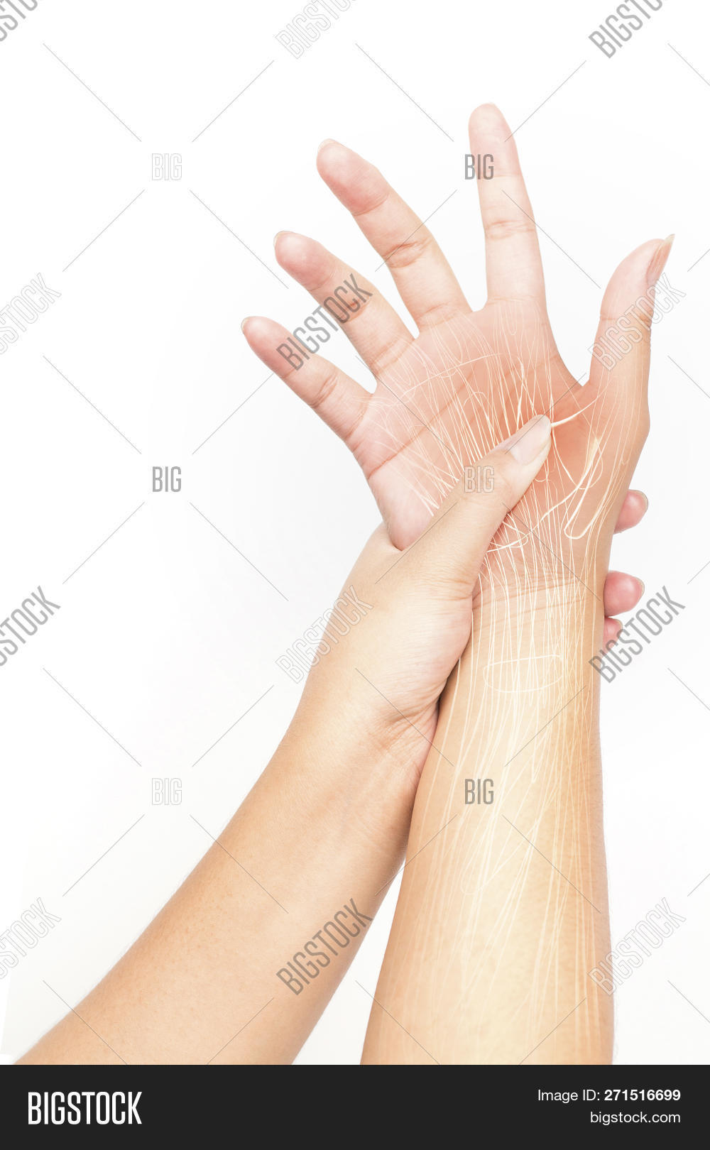 Hand Muscle Injury Image & Photo (Free Trial) | Bigstock