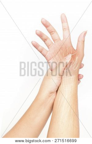 Hand Muscle Injury Image & Photo (Free Trial) | Bigstock