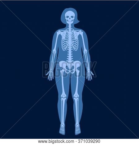Human Woman Skeleton Vector & Photo (Free Trial) | Bigstock