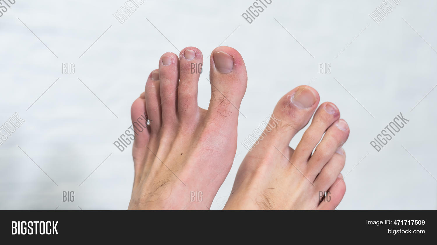 Mans Toes Showing What Image & Photo (Free Trial) | Bigstock