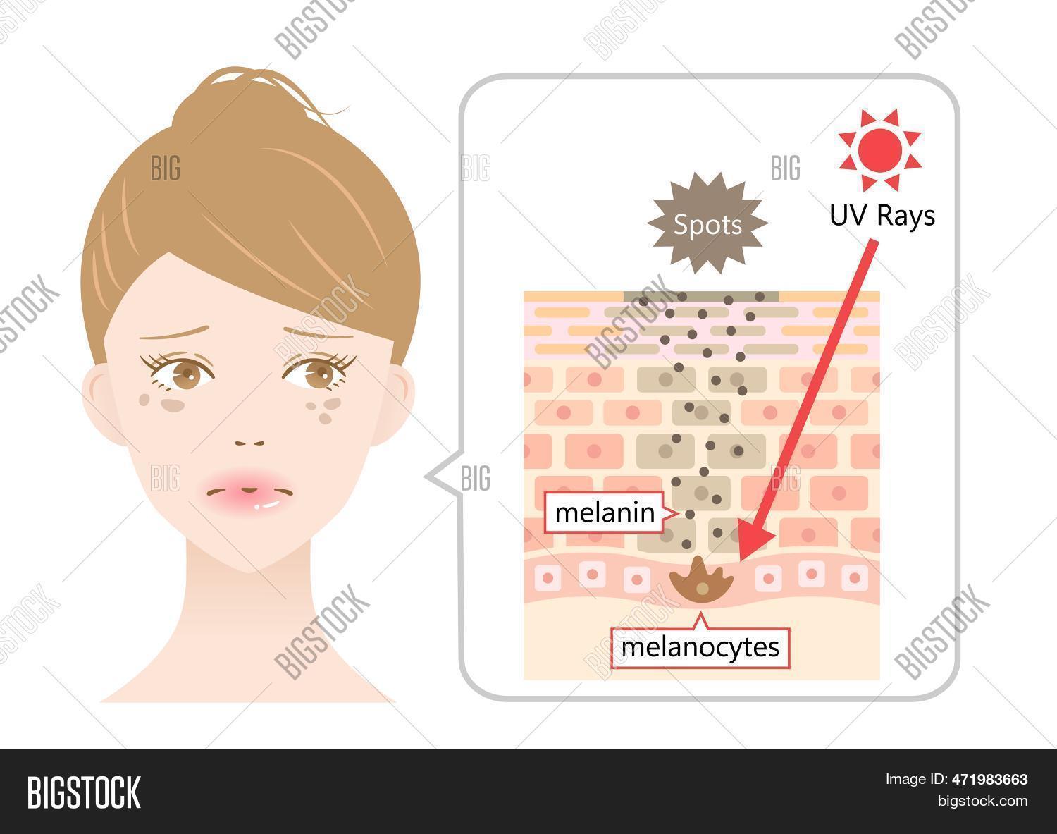 Sun's Uv Radiation Image & Photo (Free Trial) | Bigstock