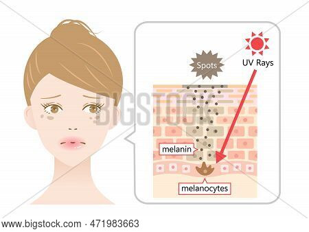 Sun's Uv Radiation Image & Photo (Free Trial) | Bigstock